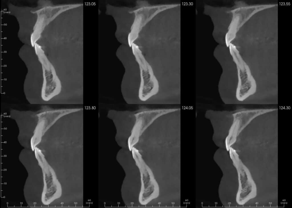 Radiodontics - CBCT Reports | Oral Radiologists