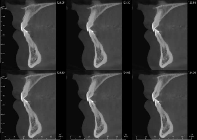 Radiodontics - CBCT Reports | Oral Radiologists