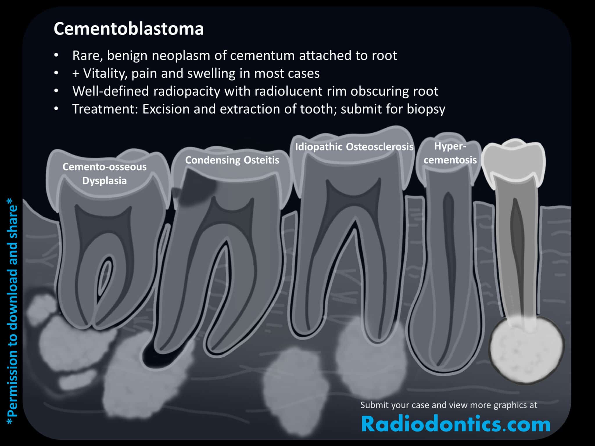 Apical Radiopacities - Radiodontics