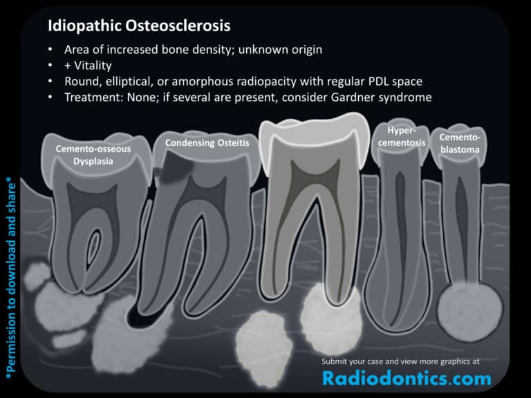 Apical Radiopacities - Radiodontics