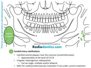 Panoramic Radiopacities - Radiodontics