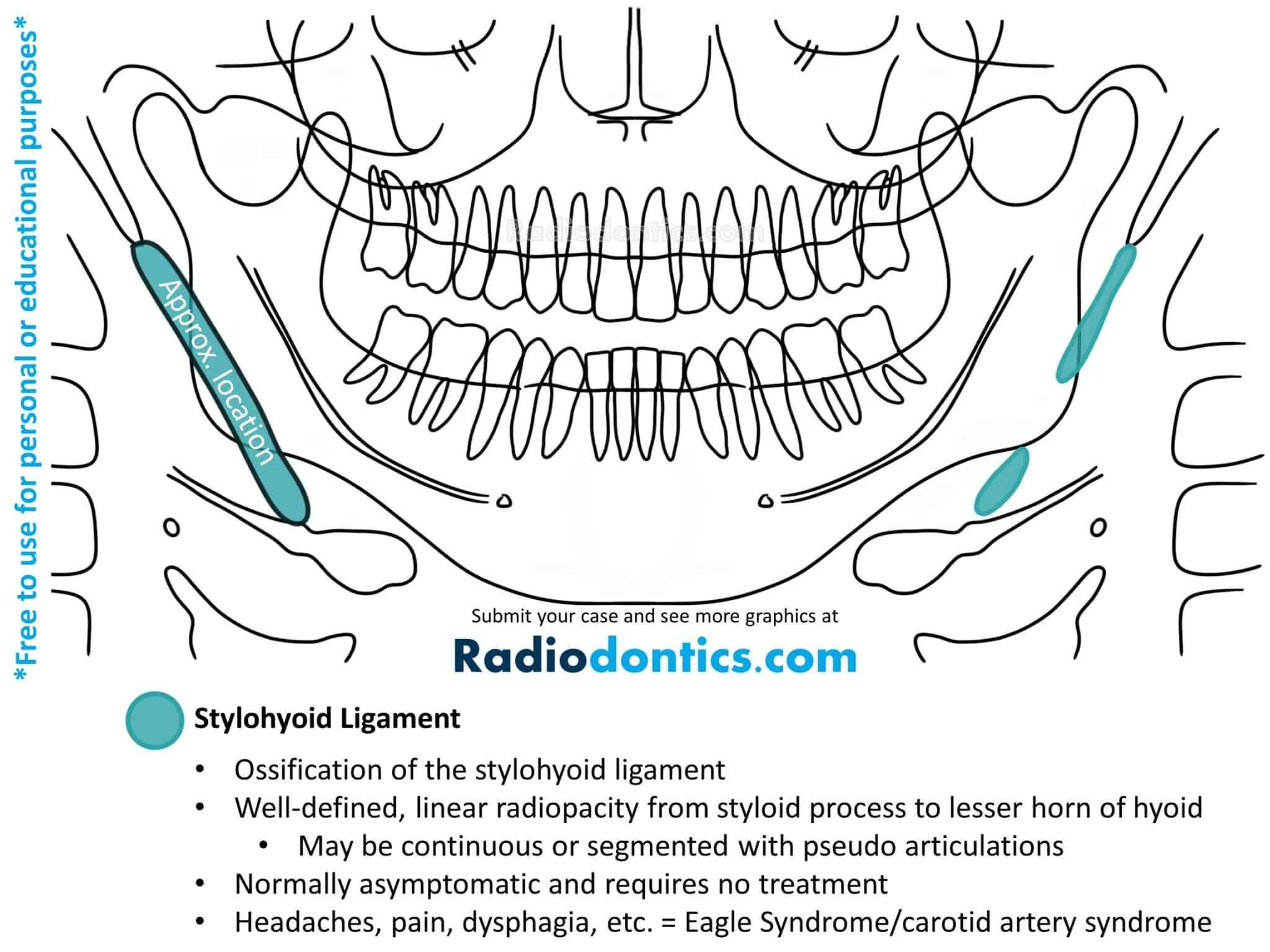 Panoramic Radiopacities - Radiodontics